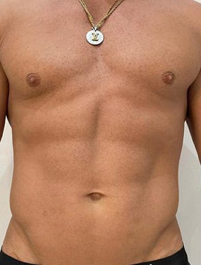 Ultra Tesla | HI-EMT Machine | Sculpt Pro Aesthetics