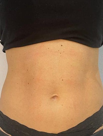 Ultra Tesla | HI-EMT Machine | Sculpt Pro Aesthetics