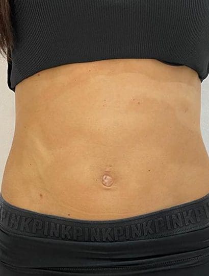 Ultra Tesla | HI-EMT Machine | Sculpt Pro Aesthetics