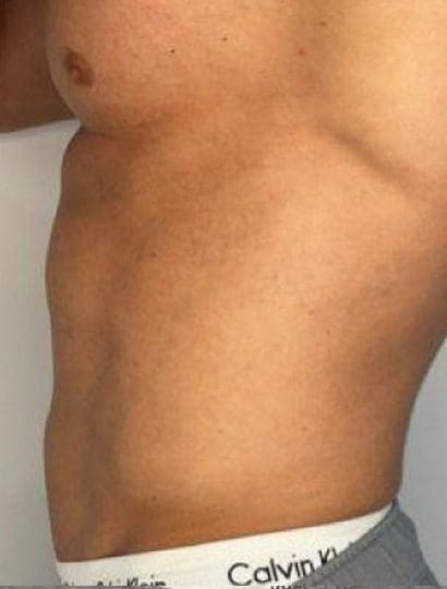 Ultra Tesla | HI-EMT Machine | Sculpt Pro Aesthetics